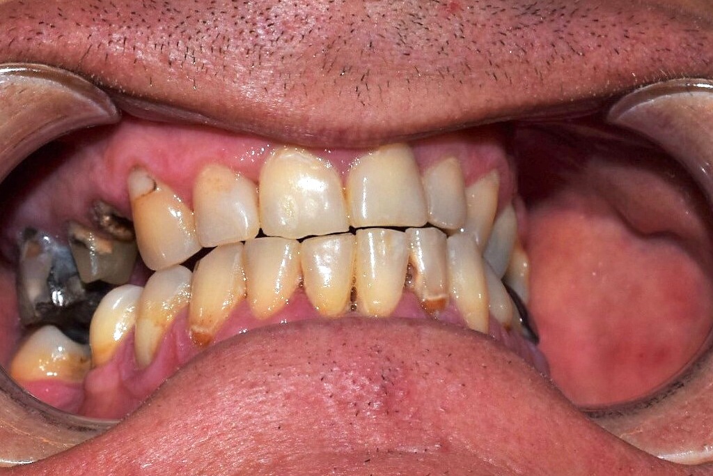 The smile gallery – Dentist in Croatia